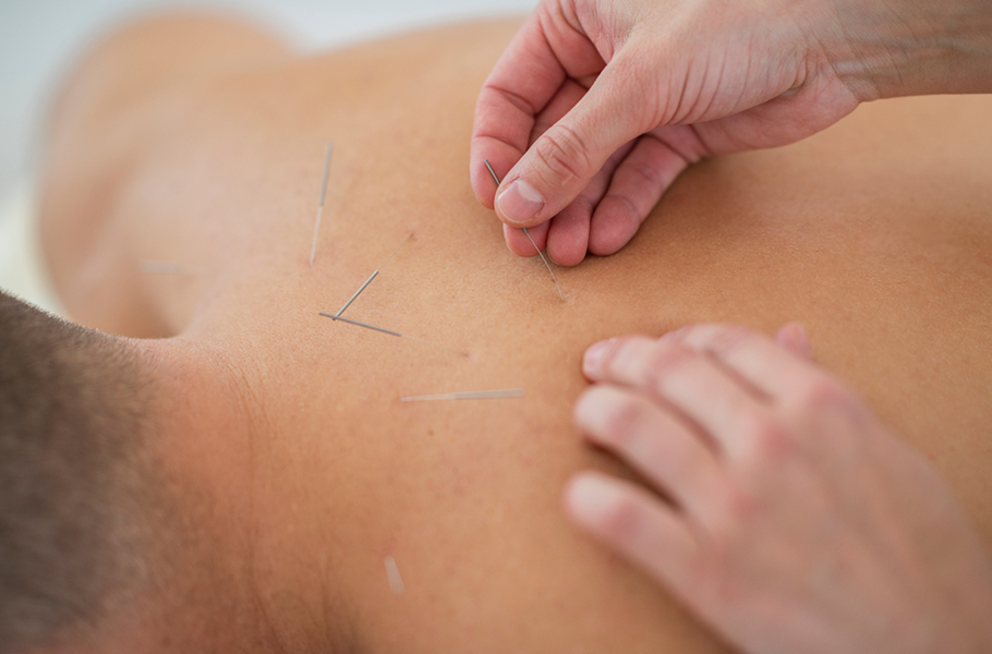 ILoveQatar.net | Where to get acupuncture treatment in Qatar