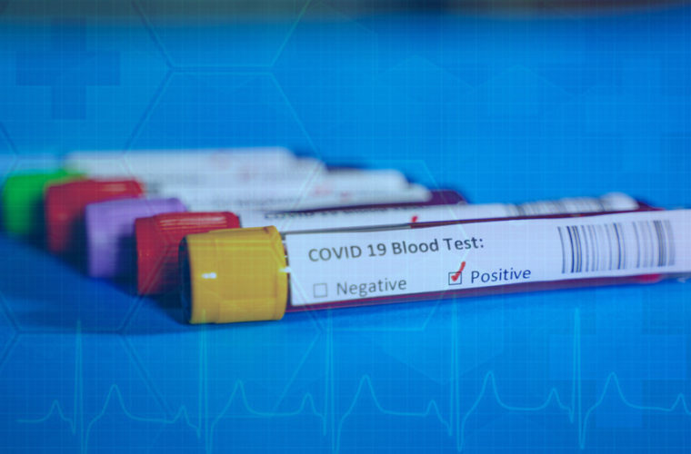 ILoveQatar.net | MoPH announces 6 new recovered cases, 13 new confirmed ...